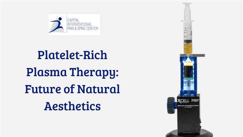 Platelet-Rich Plasma Therapy: Future of Natural Aesthetics